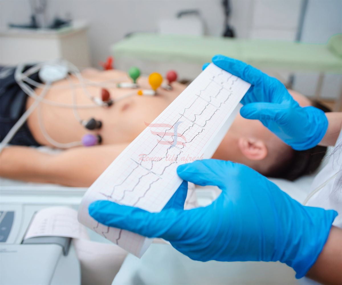 ECG Test in Kolkata | Accurate Electrocardiogram Services