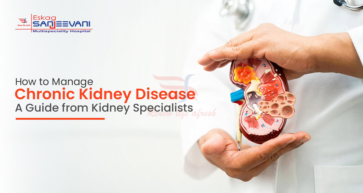 Managing Chronic Kidney Disease: Tips from Experts
