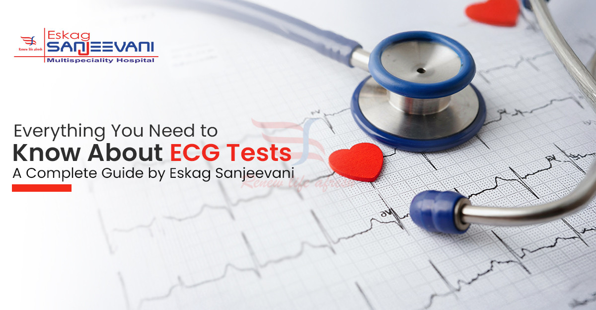 ECG Test | Complete Guide, Cost & Procedure | Eskag Sanjeevani