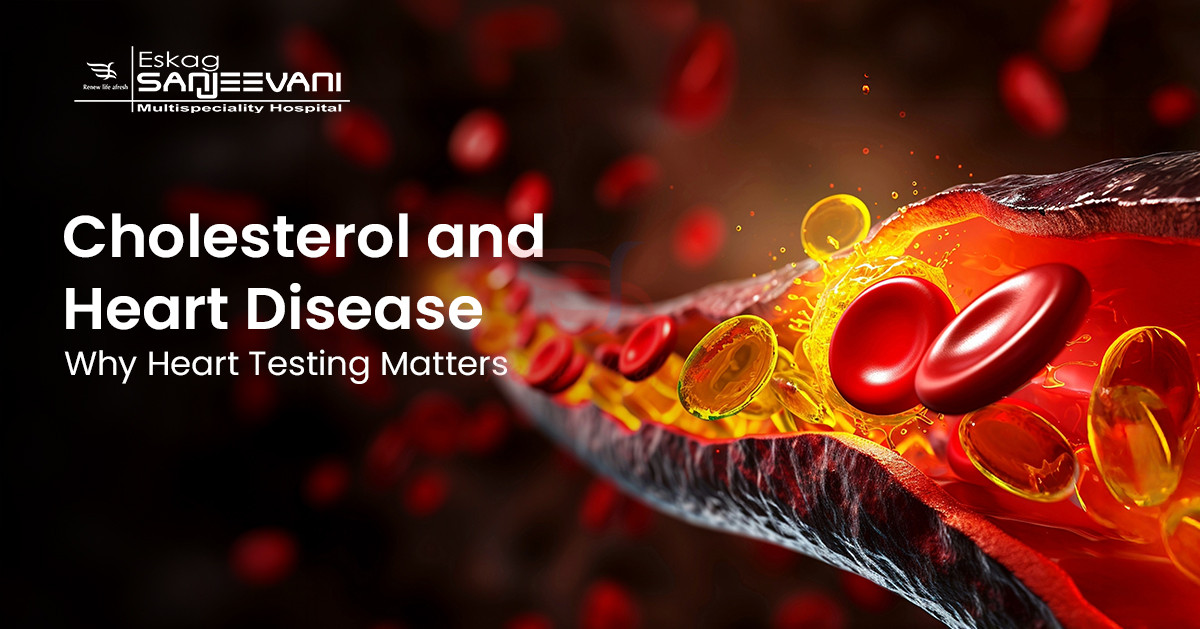 Cholesterol and Heart Disease: Why Testing Matters
