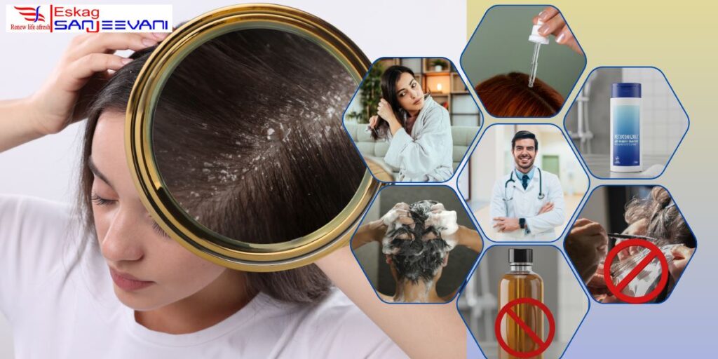 Dandruff & Scalp Issues: Causes, Treatments, and Expert's Advice