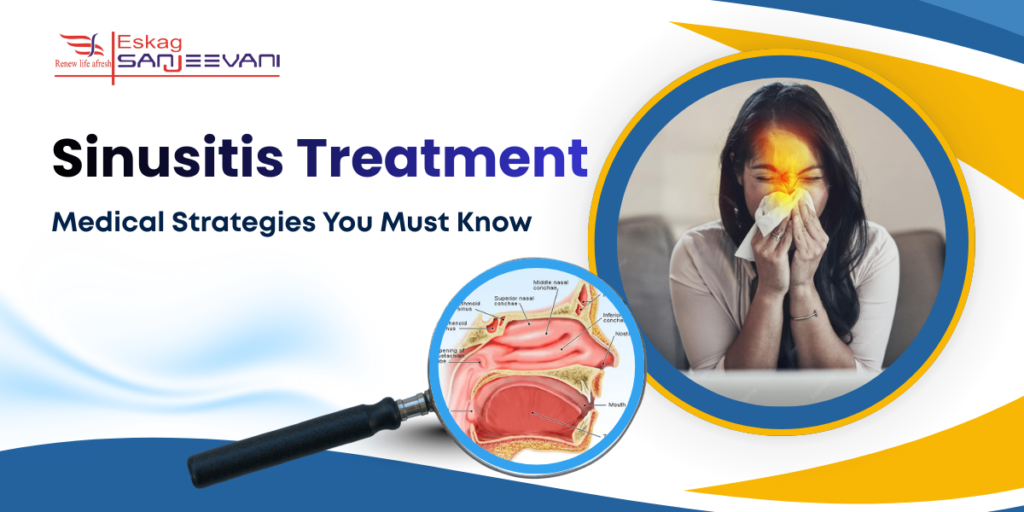 Best Treatment for Sinusitis in Kolkata | Explore ENT Care | Eskag ...