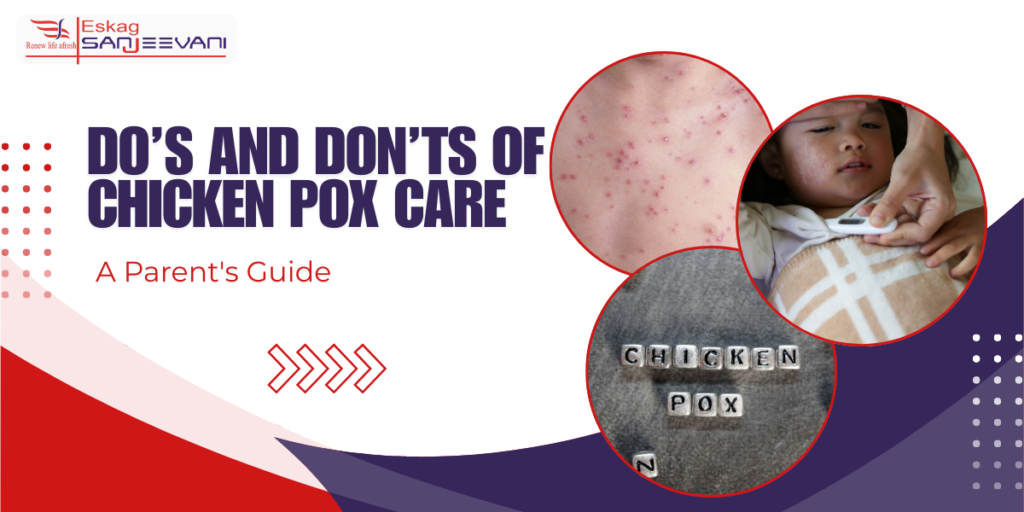 Do’s and Don’ts of Chicken Pox Care: A Parent's Guide