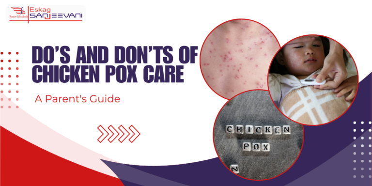 Do’s and Don’ts of Chicken Pox Care: A Parent's Guide
